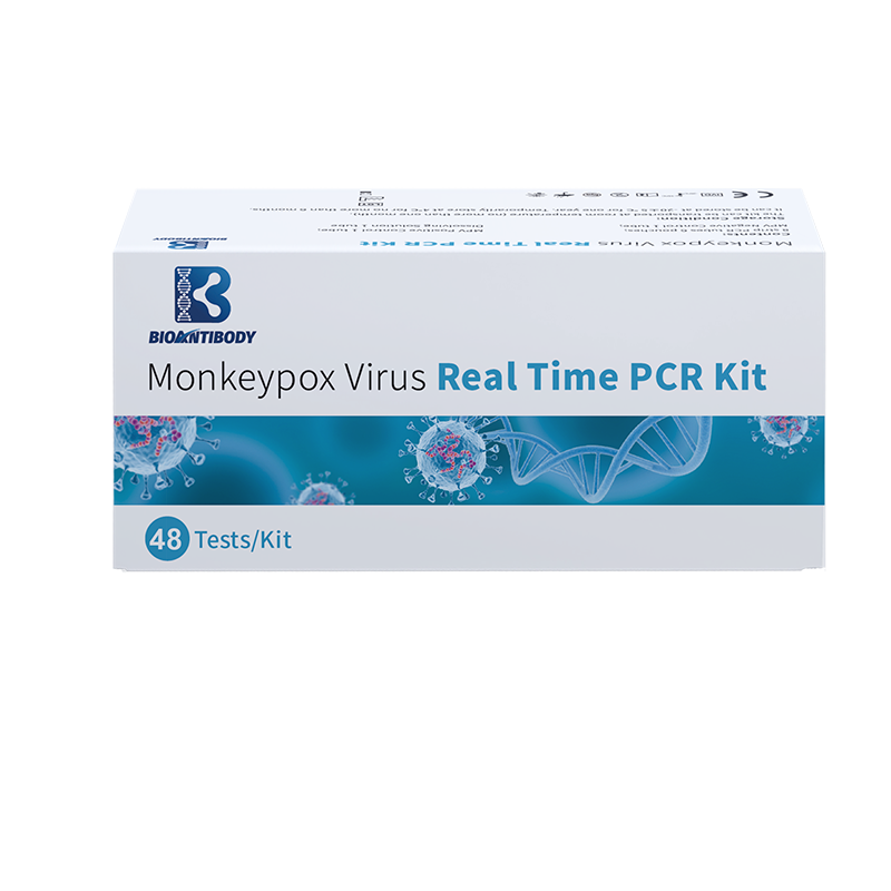 China Monkeypox Virus Real Time PCR Kit factory and manufacturers ...