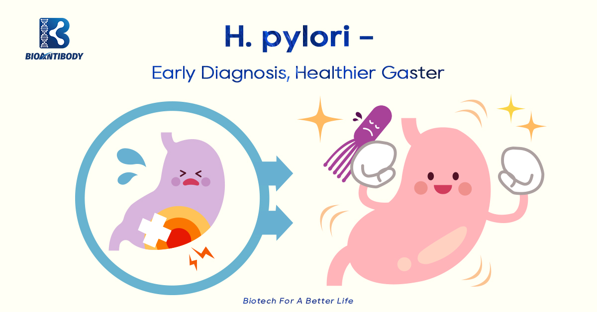 News - A Good H. Pylori Is A Dead H. Pylori